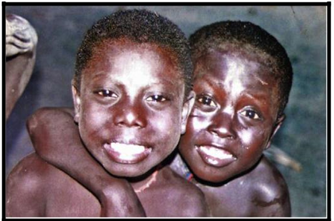 Classification of Races – Physical and Biological : Anthropology