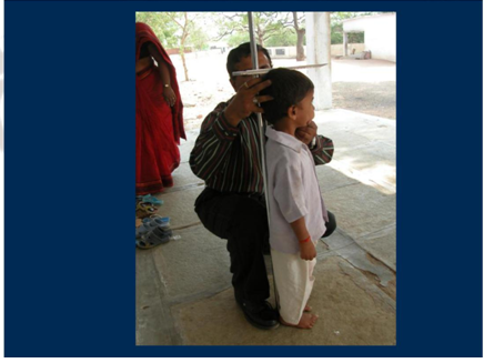 Nutritional Status assessment of children and Adults – Human growth ...