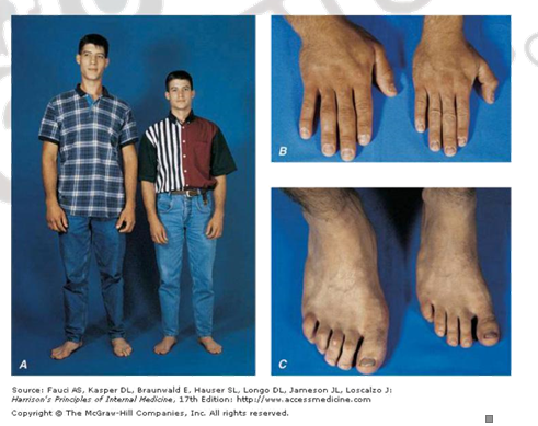 Abnormal Growths – Human growth, development and nutrition