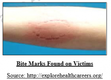 Importance of Dental Records in Forensic Odontology – Forensic anthropology