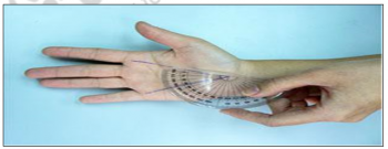 Dermatoglyphics in Forensic Anthropology – Forensic anthropology