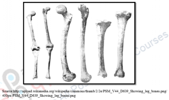 Establishment of Identity through Skeletal Remains – Forensic anthropology