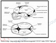 Establishment of Identity through Skeletal Remains – Forensic anthropology