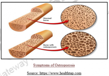 Microscopic and gross anatomy of human bones – Forensic anthropology