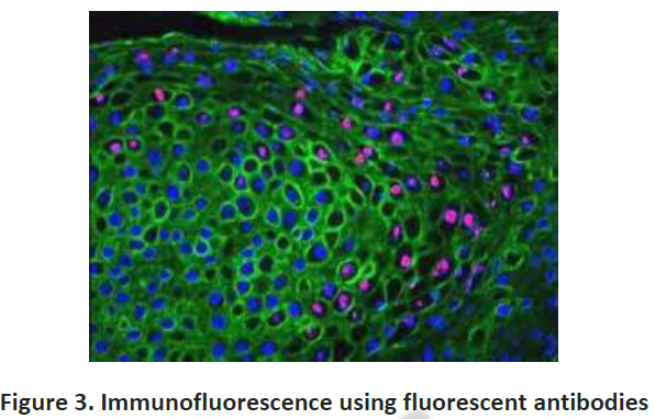 Enzyme compartmentalization in cells and tissues – Protein biochemistry ...