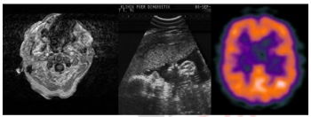 Visualization Definition and History of Visualization – Computer ...