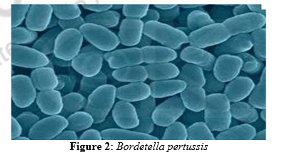 Airborne Microbial Diseases – Environmental Microbiology & Biotechnology