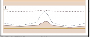Models of Slope Development: Davis, Penck, King Wood and Strahler ...