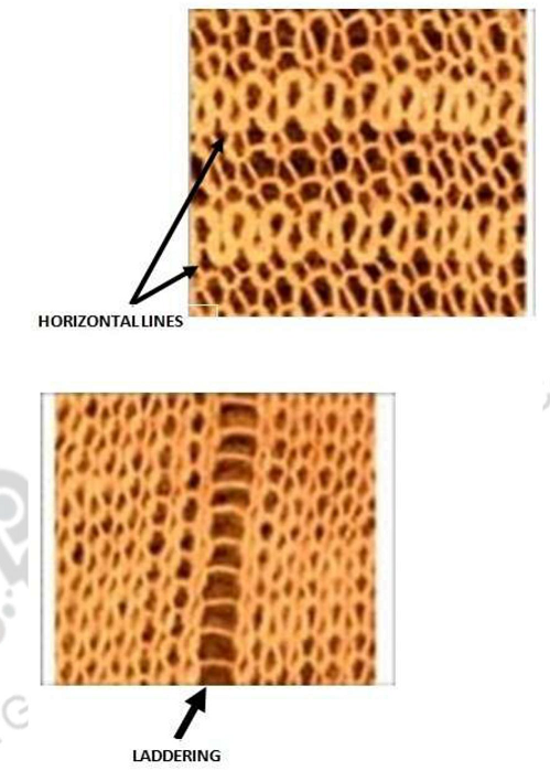 Knitted fabric defects – Textile manufacturing and testing